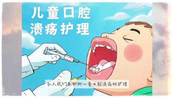 儿童口腔溃疡怎么办_家庭快速缓解方法-第3张图片-山城妙识 儿童口腔溃疡怎么办_家庭快速缓解方法-第3张图片-山城妙识