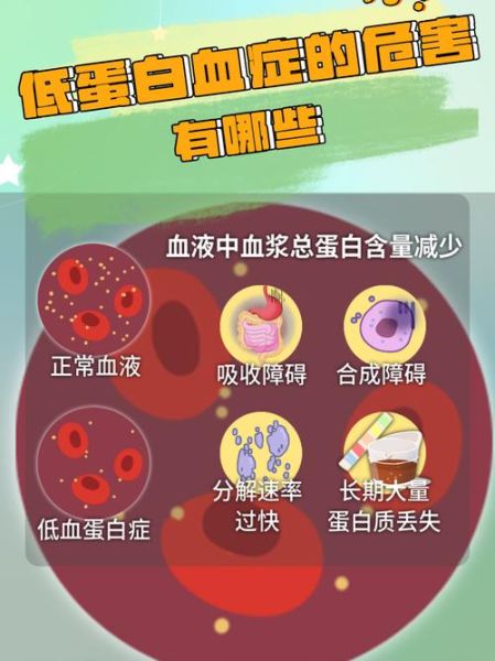 人体每天需要多少蛋白质_蛋白质不足有哪些表现-第3张图片-山城妙识