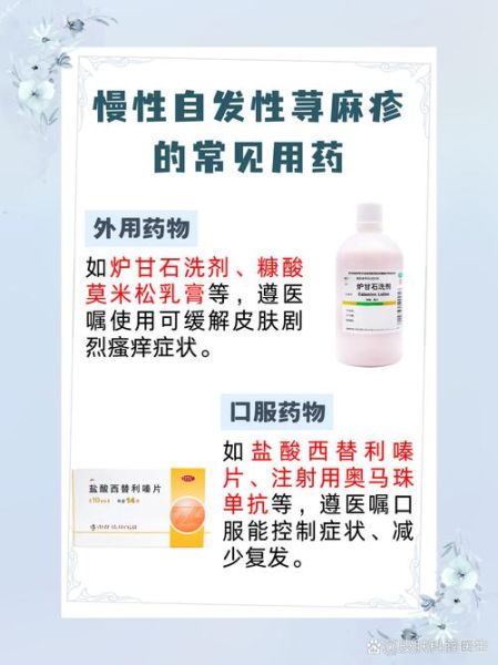 荨麻疹吃什么药好_荨麻疹止痒最快的方法-第2张图片-山城妙识