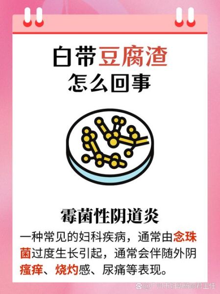 白带豆腐渣状不痒不臭_需要治疗吗-第2张图片-山城妙识 白带豆腐渣状不痒不臭_需要治疗吗-第2张图片-山城妙识
