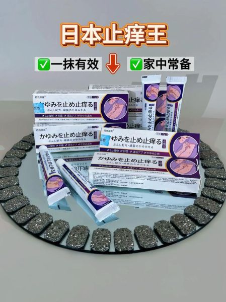 芋艿手痒怎么办_止痒最快方法-第1张图片-山城妙识 芋艿手痒怎么办_止痒最快方法-第1张图片-山城妙识