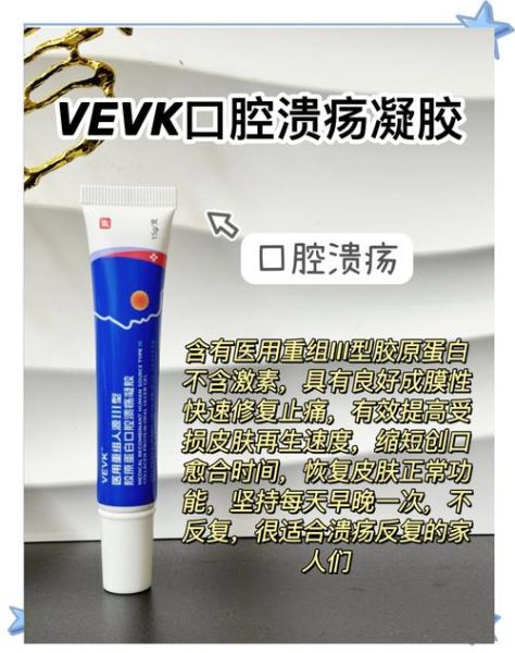 维生素b2治口腔溃疡多久见效_怎么吃最有效-第3张图片-山城妙识