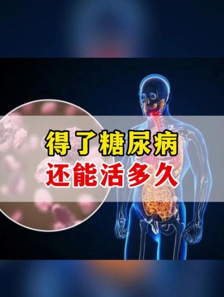 糖尿病严重吗_能活多久-第3张图片-山城妙识 糖尿病严重吗_能活多久-第3张图片-山城妙识