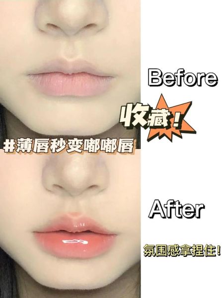 香肠嘴怎么变薄_嘴唇厚怎么自然变薄-第2张图片-山城妙识 香肠嘴怎么变薄_嘴唇厚怎么自然变薄-第2张图片-山城妙识
