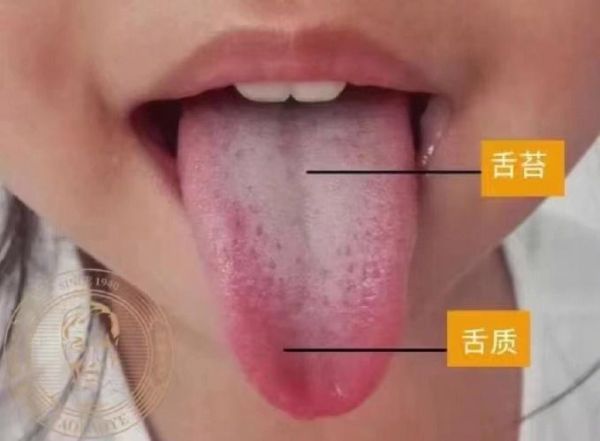 茯苓膏的功效与作用_茯苓膏适合什么人吃-第1张图片-山城妙识 茯苓膏的功效与作用_茯苓膏适合什么人吃-第1张图片-山城妙识