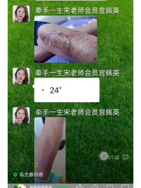 醋蛋归元液的功效与作用_醋蛋归元液能治什么病-第3张图片-山城妙识 醋蛋归元液的功效与作用_醋蛋归元液能治什么病-第3张图片-山城妙识