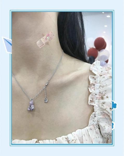 草莓印怎么快速消除_用牙膏真的有用吗-第3张图片-山城妙识 草莓印怎么快速消除_用牙膏真的有用吗-第3张图片-山城妙识