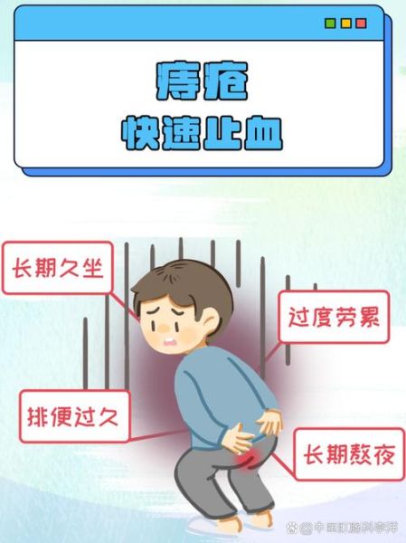 痔疮偏方真的有用吗_痔疮出血怎么快速止血-第2张图片-山城妙识