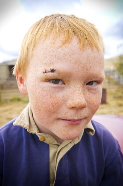 牛奶咖啡斑图片小孩_会自己消失吗-第1张图片-山城妙识