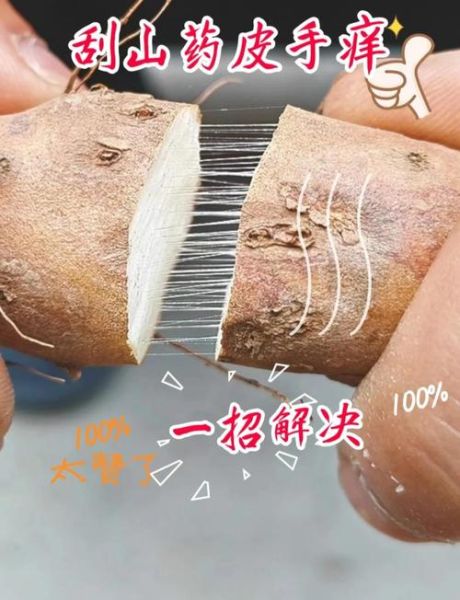 刮山药手痒怎么止痒_山药过敏最快缓解方法-第1张图片-山城妙识 刮山药手痒怎么止痒_山药过敏最快缓解方法-第1张图片-山城妙识