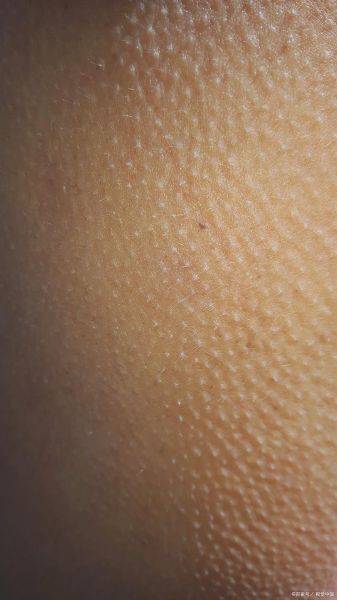 鸡皮疙瘩图片_为什么会起鸡皮疙瘩-第1张图片-山城妙识