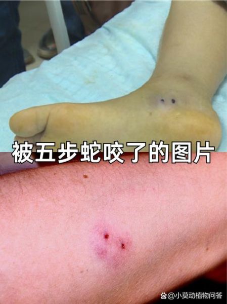 五步蛇咬伤怎么处理_被五步蛇咬了多久有反应-第1张图片-山城妙识 五步蛇咬伤怎么处理_被五步蛇咬了多久有反应-第1张图片-山城妙识