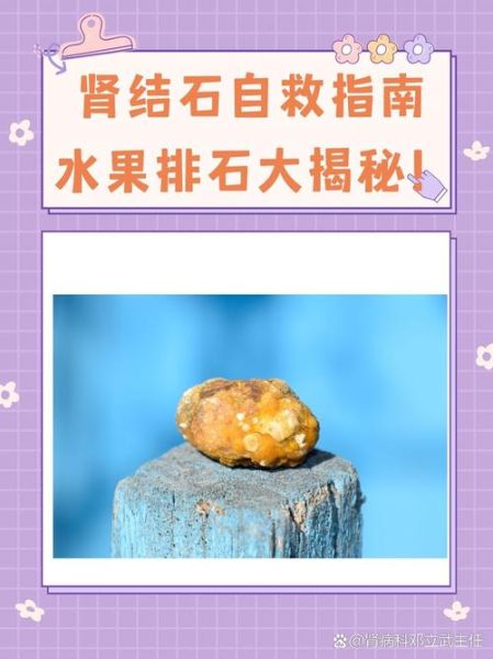 胆结石最怕三种水果_吃什么水果能排石-第3张图片-山城妙识 胆结石最怕三种水果_吃什么水果能排石-第3张图片-山城妙识