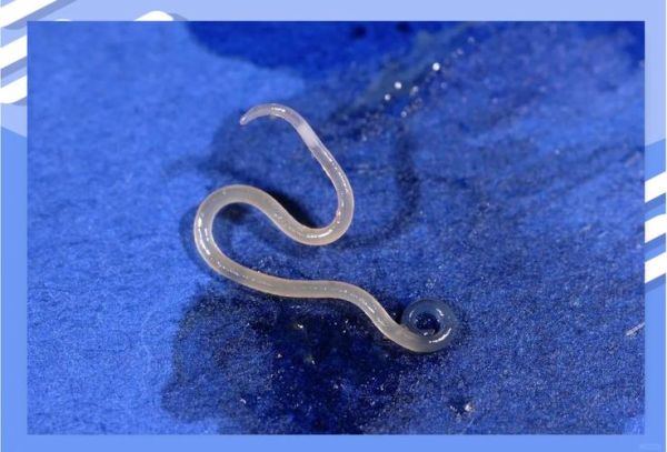 醉虾有寄生虫吗_醉虾寄生虫怎么杀死-第1张图片-山城妙识