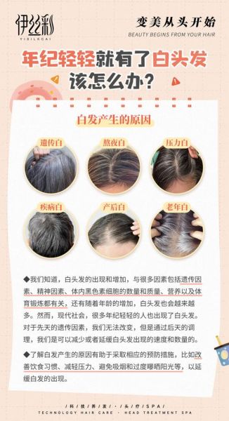 白头发怎么治_最简单的方法是什么-第2张图片-山城妙识