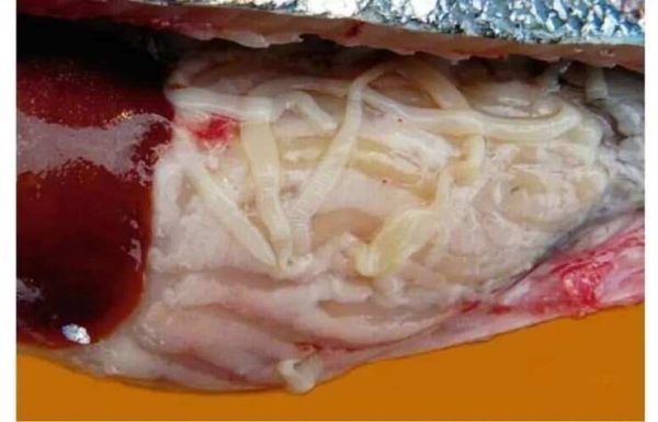 猪肉绦虫感染症状_猪肉绦虫潜伏期多久-第2张图片-山城妙识