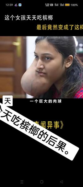 女人吃槟榔有什么反应_女人吃槟榔的危害有哪些-第2张图片-山城妙识 女人吃槟榔有什么反应_女人吃槟榔的危害有哪些-第2张图片-山城妙识