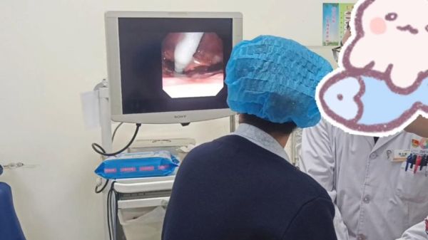 做完咽喉镜后悔死了_咽喉镜副作用有哪些-第2张图片-山城妙识