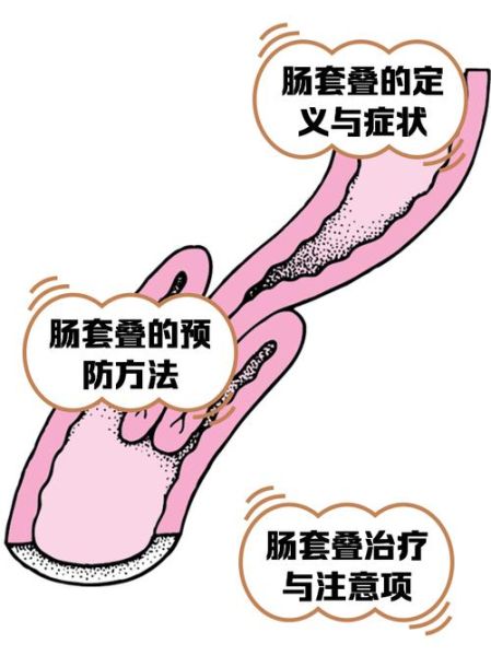 九转大肠套肠手法_怎么套才不断-第2张图片-山城妙识 九转大肠套肠手法_怎么套才不断-第2张图片-山城妙识