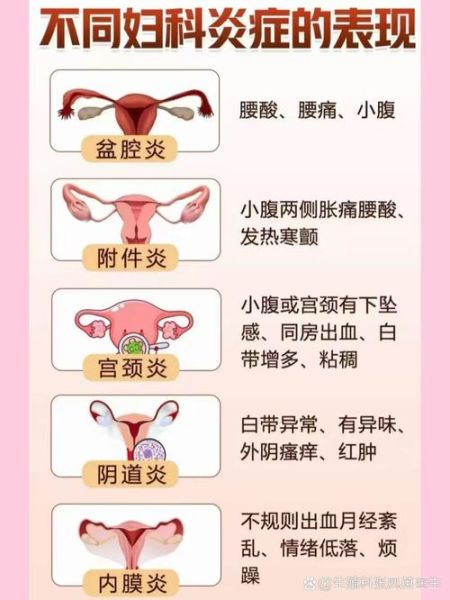 顺产9天同房了七八次_会不会感染-第3张图片-山城妙识 顺产9天同房了七八次_会不会感染-第3张图片-山城妙识