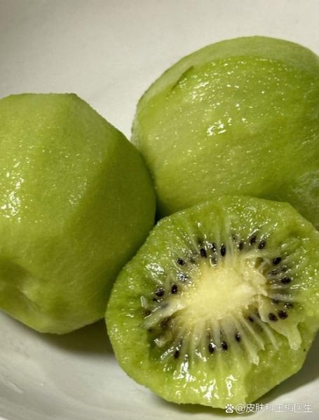 吃苹果15天皮肤变好_多久见效-第3张图片-山城妙识 吃苹果15天皮肤变好_多久见效-第3张图片-山城妙识