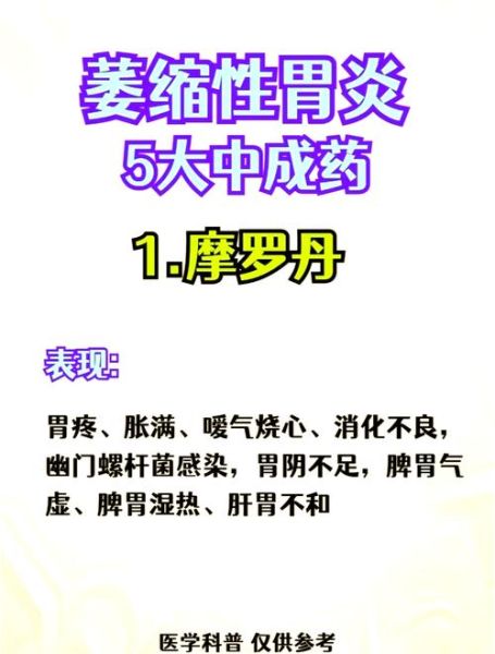 胃炎怎么治疗好得快_胃炎吃什么药最有效-第1张图片-山城妙识 胃炎怎么治疗好得快_胃炎吃什么药最有效-第1张图片-山城妙识