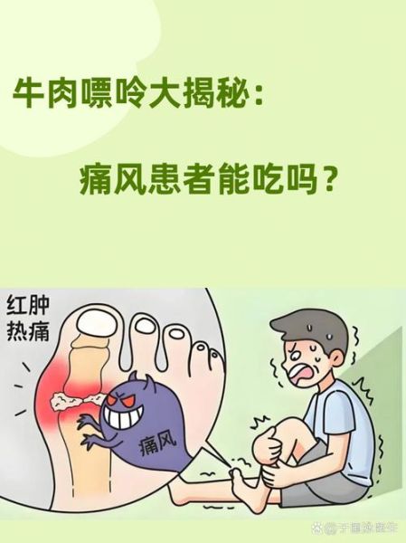 牛肉哪些人不能吃_痛风患者能吃牛肉吗-第1张图片-山城妙识