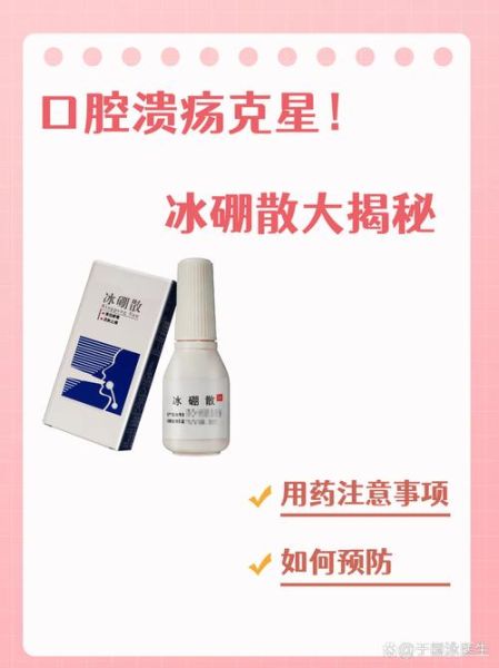 口腔溃疡吃什么药好使_口腔溃疡多久能好-第3张图片-山城妙识