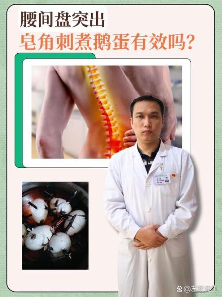 皂角刺治腰间盘突出怎么用_皂角刺外敷配方-第2张图片-山城妙识