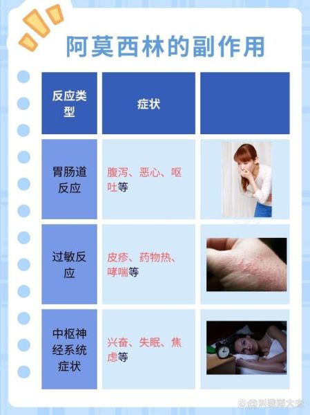 感冒发烧吃什么药退烧_成人儿童用药区别-第3张图片-山城妙识