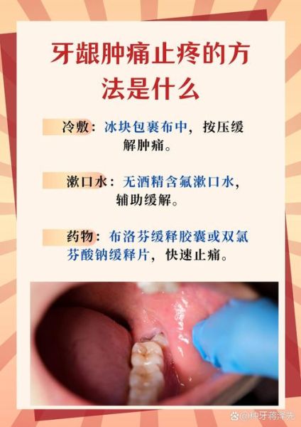 孕妇牙龈肿痛怎么办_能用什么药缓解-第2张图片-山城妙识