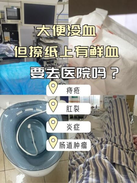 大便没血但擦纸上有血_是怎么回事-第1张图片-山城妙识 大便没血但擦纸上有血_是怎么回事-第1张图片-山城妙识