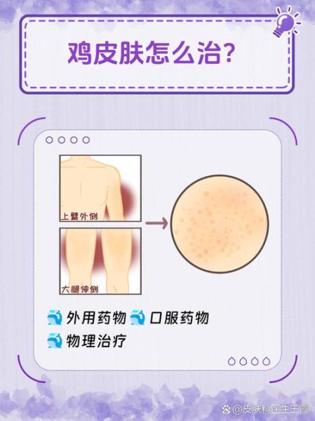 小鸡上长疙瘩了怎么回事_小鸡皮肤长疙瘩怎么办-第1张图片-山城妙识