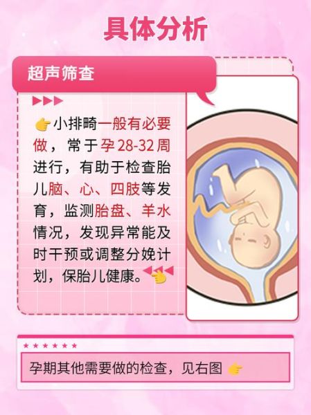 小排畸检查时间_小排畸检查注意事项-第2张图片-山城妙识