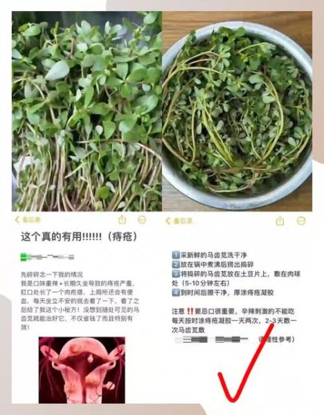 马齿苋治痔疮怎么用_马齿苋治痔疮效果最好的方法-第1张图片-山城妙识