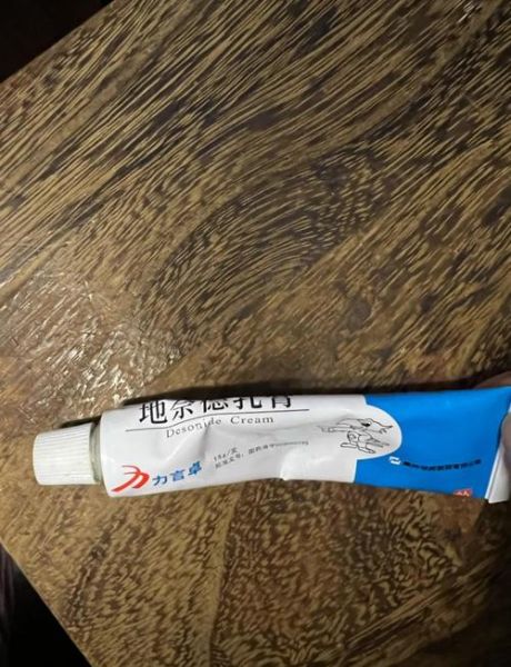 抗过敏软膏有哪些_儿童能用吗-第3张图片-山城妙识