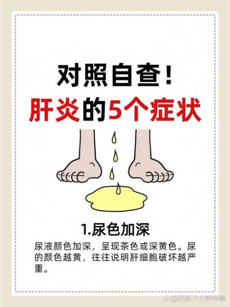 女性肝病早期有哪些症状_肝病征兆怎么判断-第2张图片-山城妙识 女性肝病早期有哪些症状_肝病征兆怎么判断-第2张图片-山城妙识