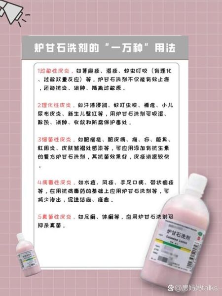炉甘石洗剂能止痒吗_炉甘石的功效与作用-第2张图片-山城妙识