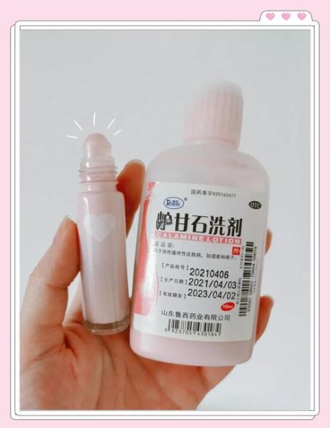 炉甘石洗剂能止痒吗_炉甘石的功效与作用-第3张图片-山城妙识