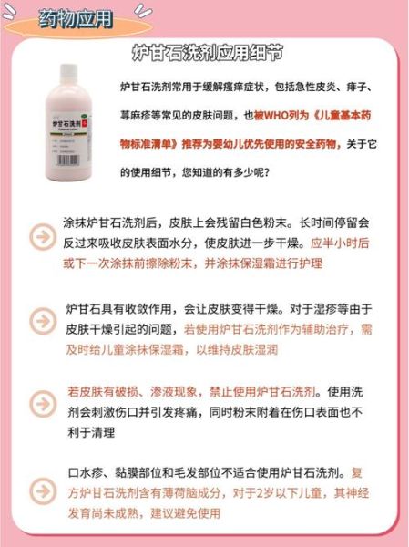 炉甘石洗剂能止痒吗_炉甘石的功效与作用-第1张图片-山城妙识