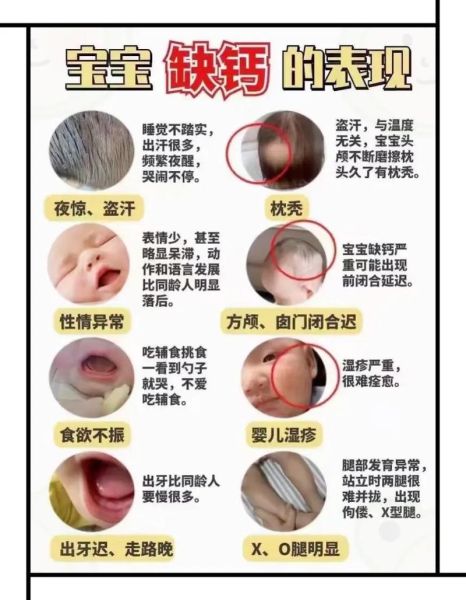 婴儿缺钙有哪些表现_宝宝缺钙怎么判断-第1张图片-山城妙识