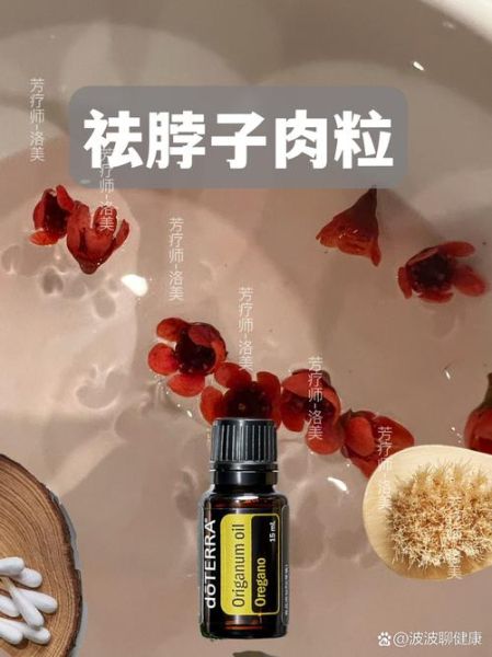 牛至精油治疗扁平疣_怎么用才有效-第1张图片-山城妙识 牛至精油治疗扁平疣_怎么用才有效-第1张图片-山城妙识
