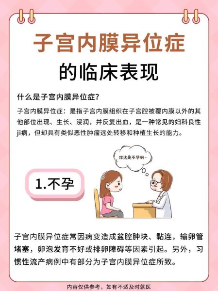 子宫内膜异位症能怀孕吗_子宫内膜异位症怎么治疗-第1张图片-山城妙识
