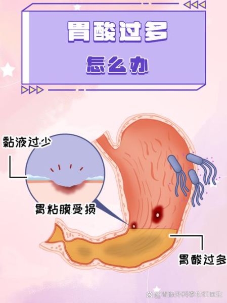 胃酸烧心喝水一招永不复发_胃酸烧心喝水真的有用吗-第1张图片-山城妙识