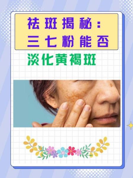 三七粉能祛斑吗_三七粉去黄褐斑效果怎么样-第1张图片-山城妙识