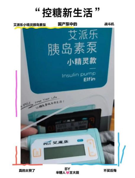 胰岛素泵多少钱_胰岛素泵适合哪些人-第3张图片-山城妙识