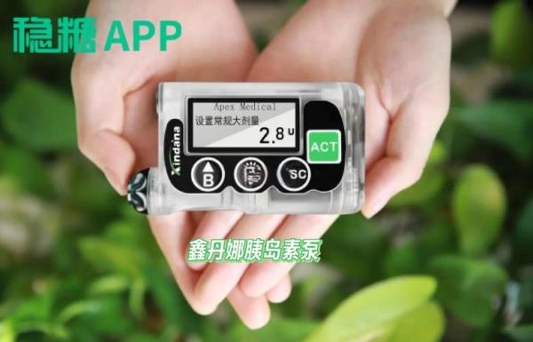 胰岛素泵多少钱_胰岛素泵适合哪些人-第1张图片-山城妙识