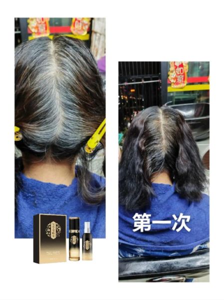 生发乌发秘方真的有用吗_白发变黑发最简单的方法-第1张图片-山城妙识