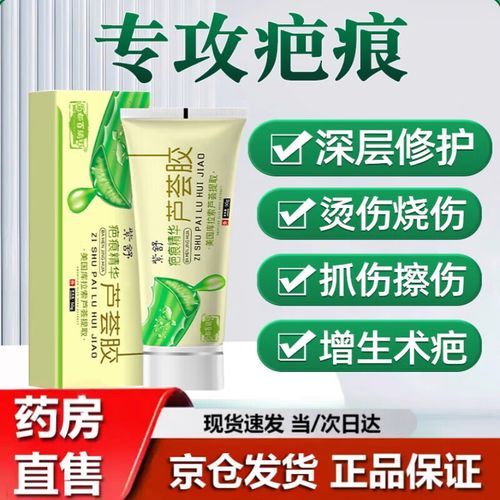 芦荟胶可以去疤痕吗_芦荟胶去疤痕效果怎么样-第1张图片-山城妙识