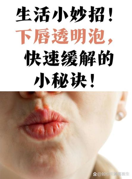 香肠嘴怎么变薄小窍门_如何让嘴唇自然变薄-第3张图片-山城妙识 香肠嘴怎么变薄小窍门_如何让嘴唇自然变薄-第3张图片-山城妙识